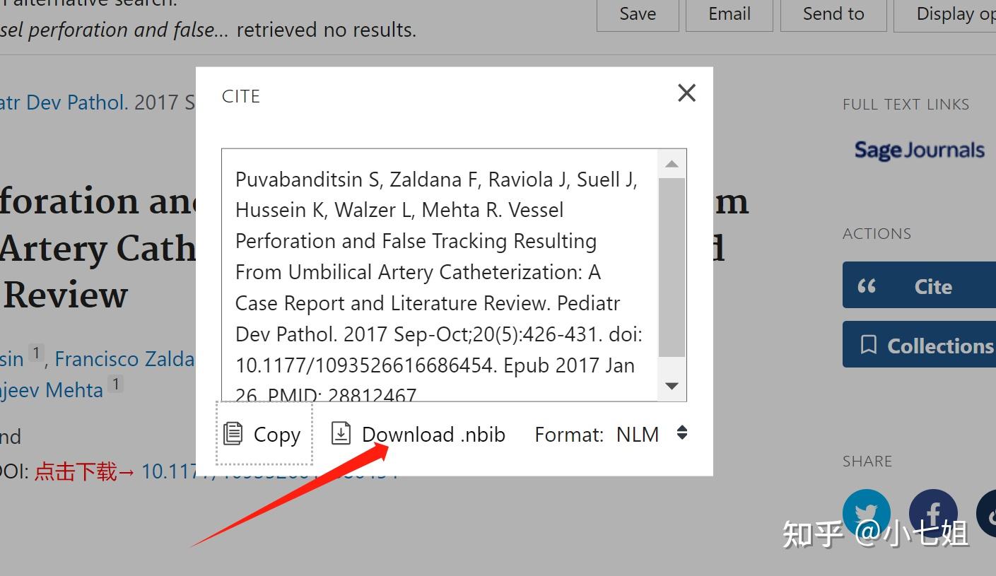 如何把PubMed下载的(.nbib)格式文件，导入EndNote - 知乎