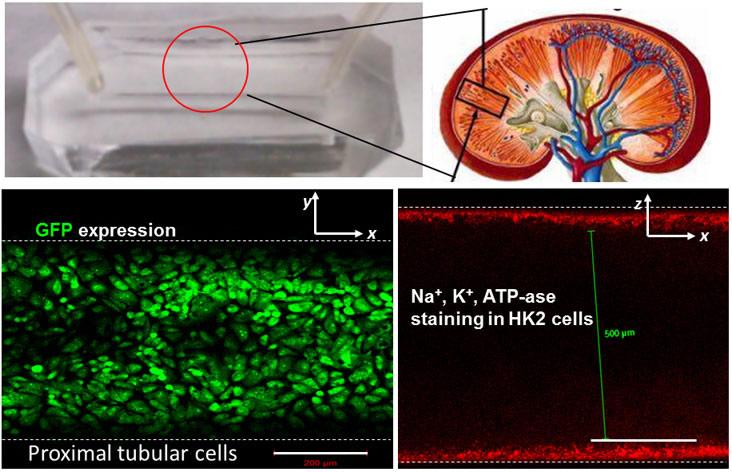 器官芯片实例介绍（三）Kidney-on-a-chip 芯片肾 - 知乎