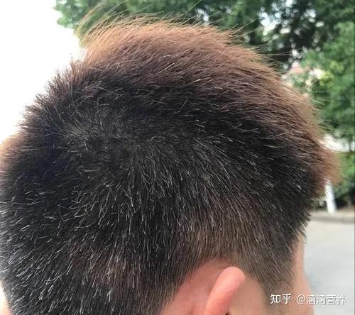身体好不好,看你的头发就知道!出现这些情况,赶紧对应补起来 知乎