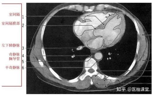 教你读懂胸部CT - 知乎