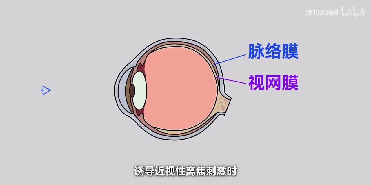 AI离焦护眼是不是噱头荣耀Magic V3上手体验 - 知乎