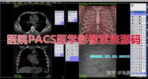 大型医院影像PACS系统三维重建技术（获取数据、预处理、配准、重建和可视化） - 知乎