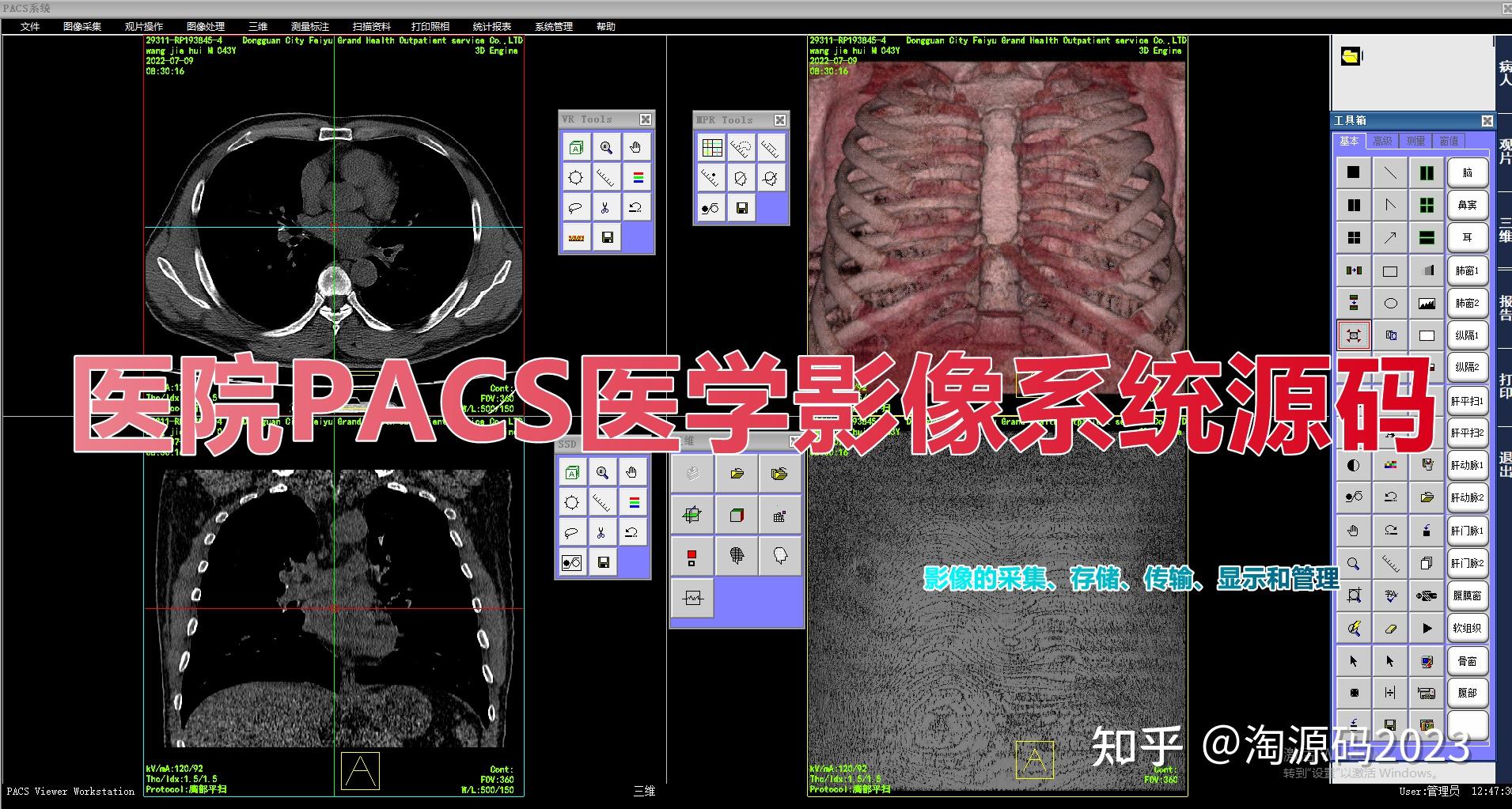 大型医院影像PACS系统三维重建技术（获取数据、预处理、配准、重建和可视化） - 知乎