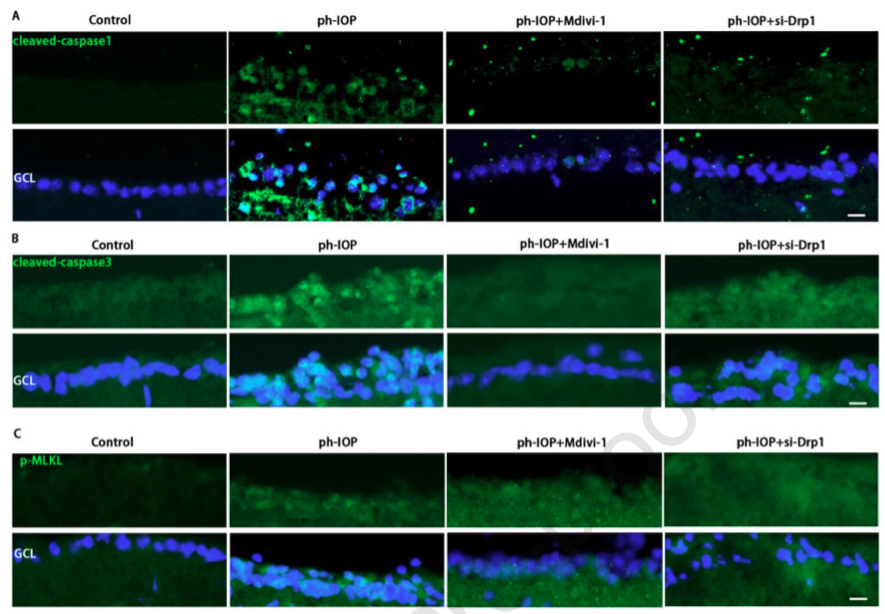 Redox Biology丨氧化应激顶刊丨病理性高眼压通过 Drp1 诱导线粒体功能障碍并导致PANoptosis - 知乎