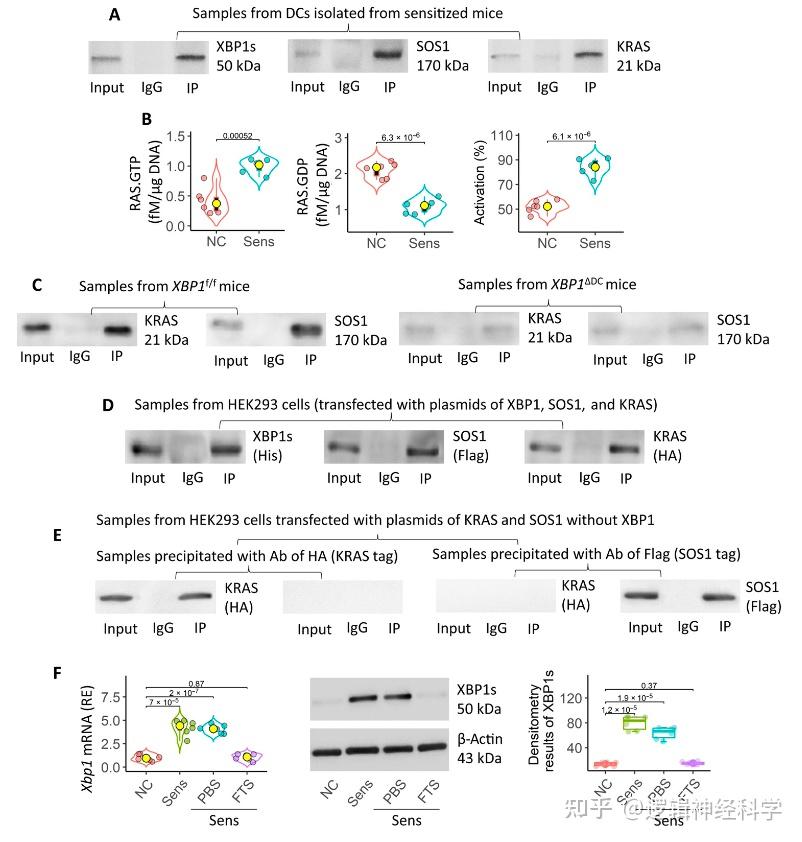 Sci Signal︱深圳大学杨平常团队阐明XBP1-TIM4信号轴在过敏性气道炎症中的分子机制 - 知乎