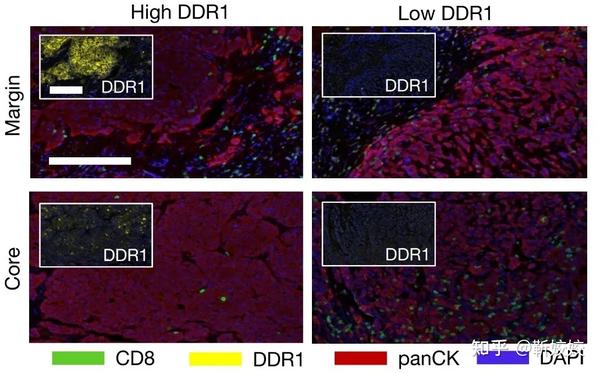 Nature热点 I DDR1或将成为三阴乳腺癌治疗新靶点 - 知乎