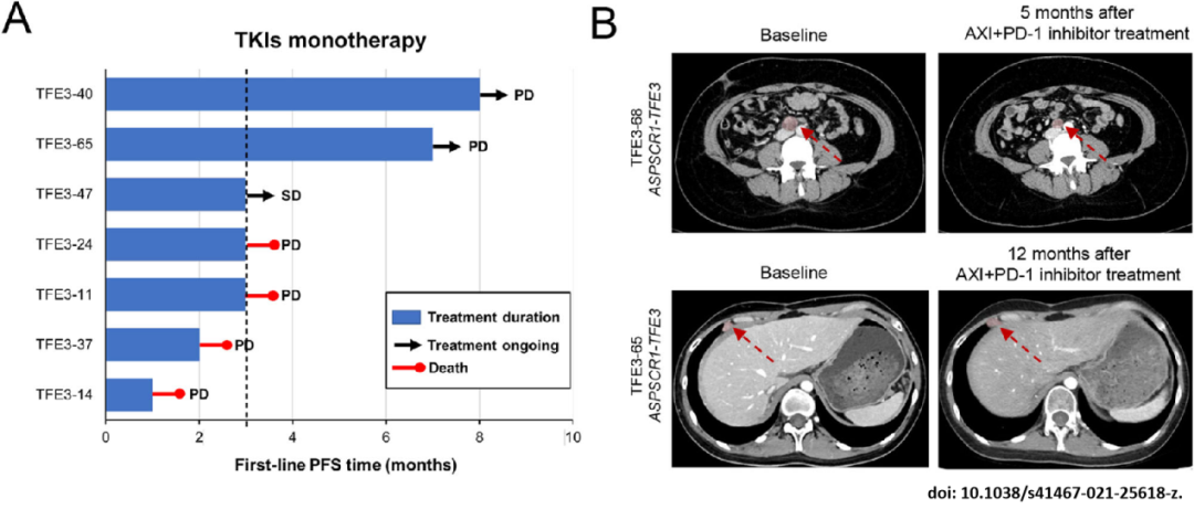 与肿瘤相关的那些明星基因：肾癌之TFE3 - 知乎