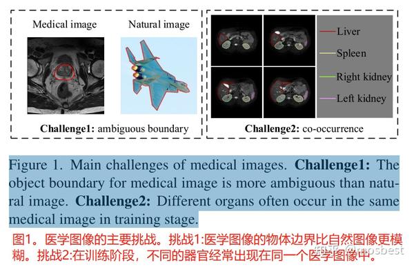 CVPR: C-CAM: Causal CAM for Weakly Supervised Semantic Segmentation on Medical Image - 知乎