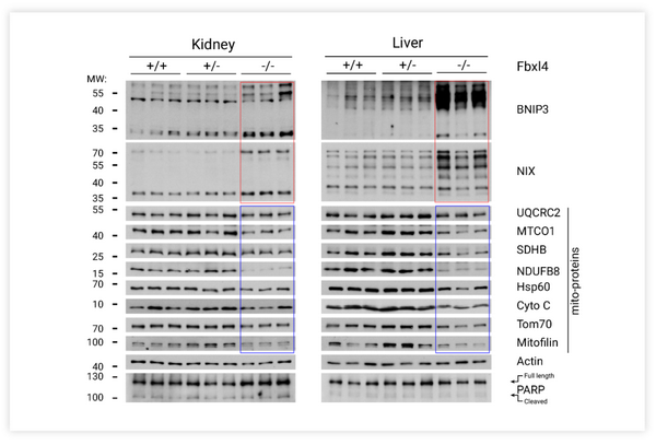 超详细 | 线粒体自噬机制及检测方法大汇总 - 知乎