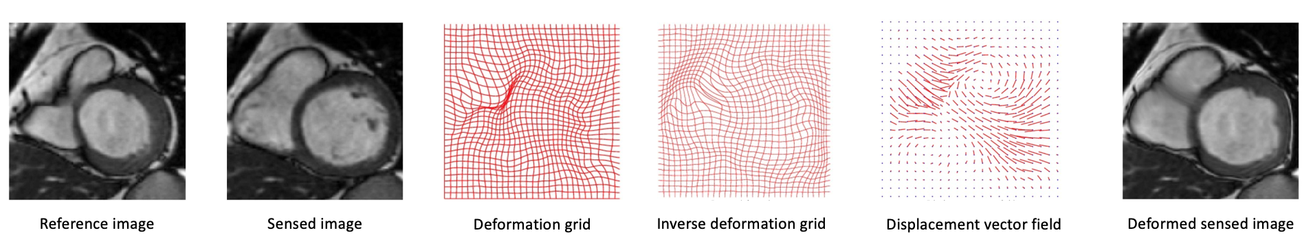 Image Registration: From SIFT to Deep Learning - 知乎