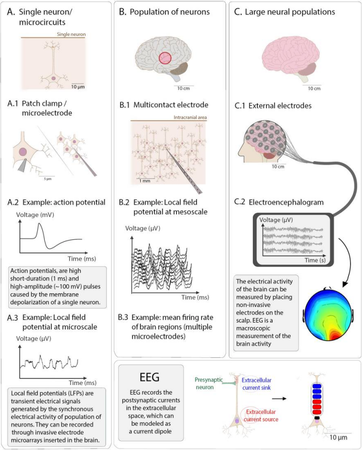 脑电图计算模型及应用（上） - 知乎