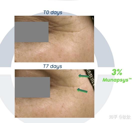 Munapsys/Acetyl Hexapeptide-1,anti-wrinkle peptide - 知乎