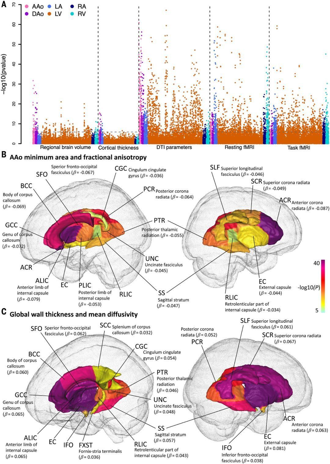 Science：“心脑连接”新证据—超4万人磁共振影像表型和遗传信息 - 知乎