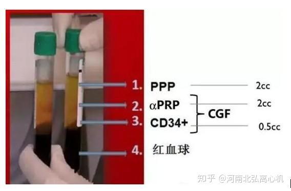 cgf与prp疗效对比 - 知乎