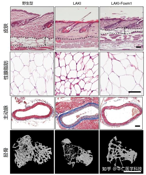 抗衰老研究的新靶点——FOXM1 - 知乎