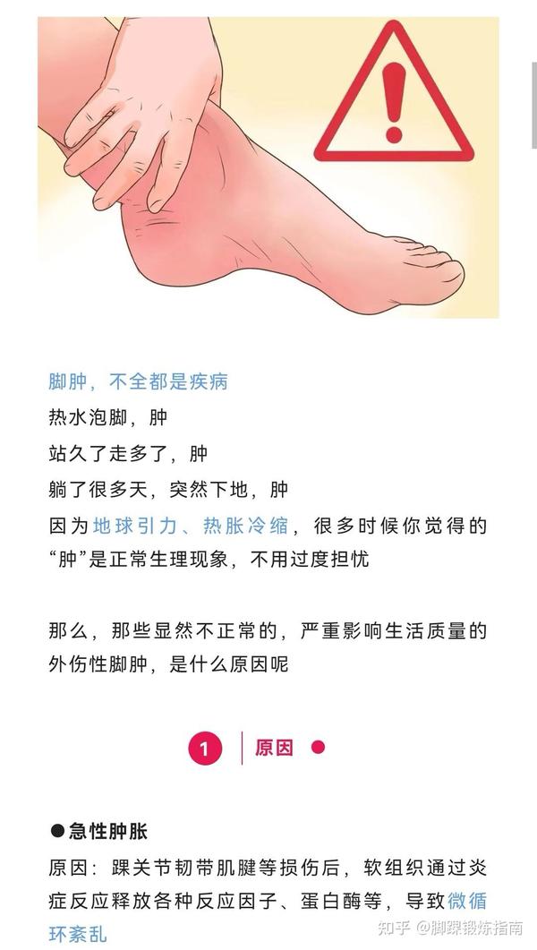 脚踝长期慢性肿胀，接地气的消肿技巧 - 知乎