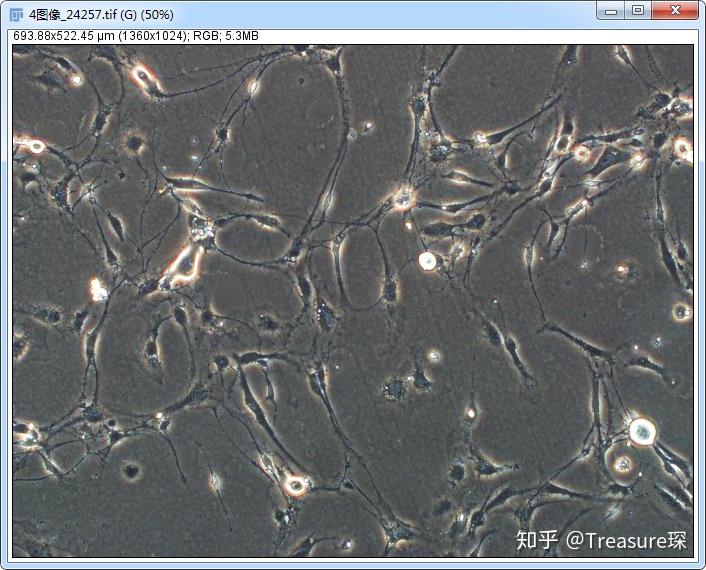ImageJ实用技巧——比例尺设置和批量添加(基本功能篇) - 知乎