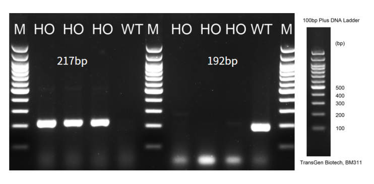 INHBE：减脂界冉冉升起的新星 - 知乎
