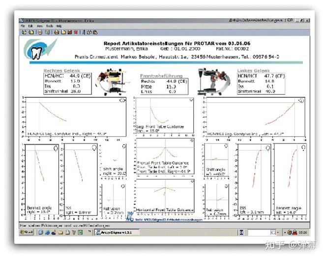 卡瓦 KaVo ARCUS digma 电子面弓齿科应用 - 知乎