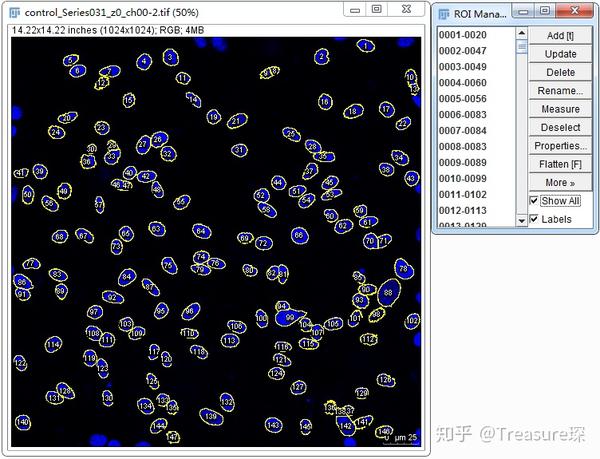 ImageJ实用技巧——单个细胞平均荧光强度自动检测(定量分析篇) - 知乎