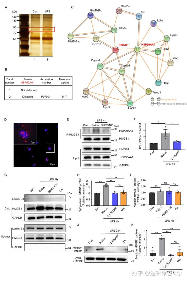 iScience︱南京大学徐运课题组揭示QHRD106作为一种新型长效的组织型激肽释放酶制剂改善缺血性脑损伤 - 知乎