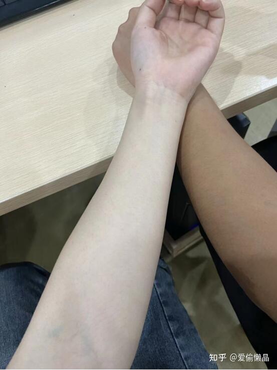 如何高效变白,去黄? 知乎