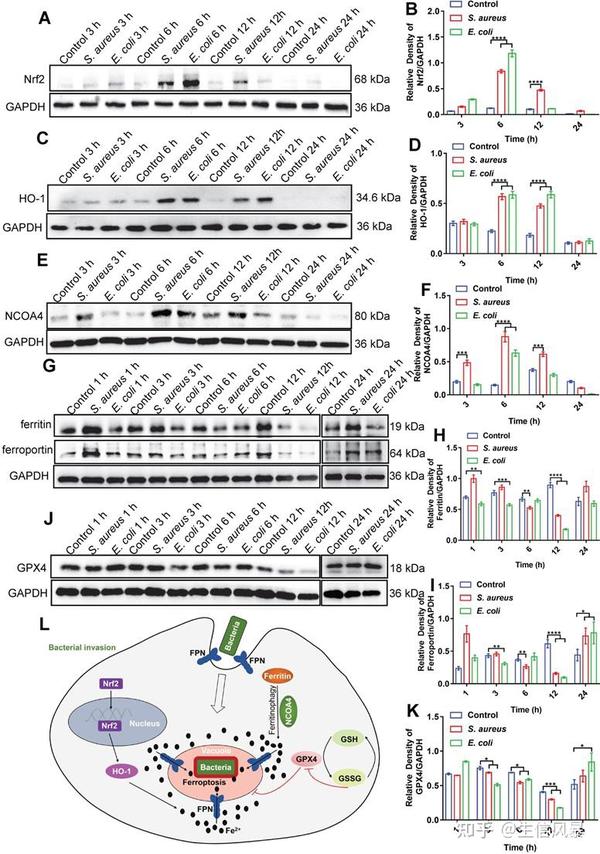 Theranostics：铁胁迫促进巨噬细胞对抗细胞内细菌 - 知乎