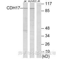 肠钙粘蛋白CDH17：单抗、双抗、CAR T“多管齐下”，胃肠道癌GIC重磅靶点！ - 知乎
