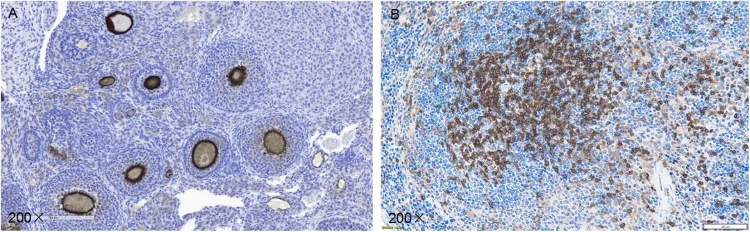 【病理专题】HE及IHC切片质量检查要点分析 - 知乎