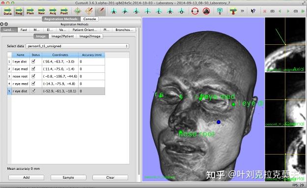 开源科学工程技术软件介绍65 – 用于图像引导治疗的研究平台CustusX - 知乎