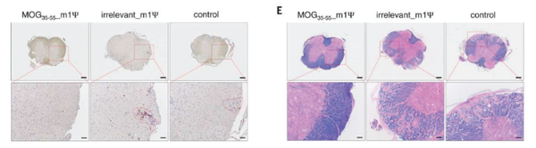 【耀文解读】mRNA制剂篇：脂质纳米颗粒（LNP）递送系统漫长的研发历程 - 知乎