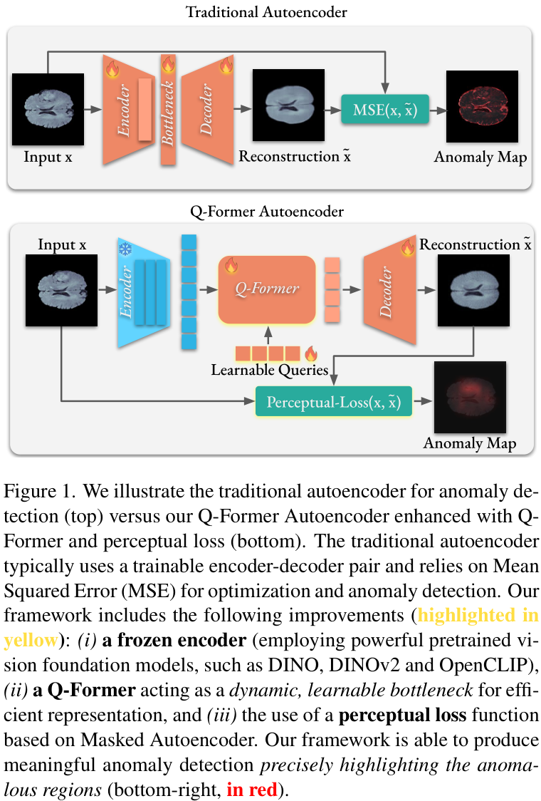 Q-Former自编码器：一个用于医学异常检测的现代化框架 - 知乎