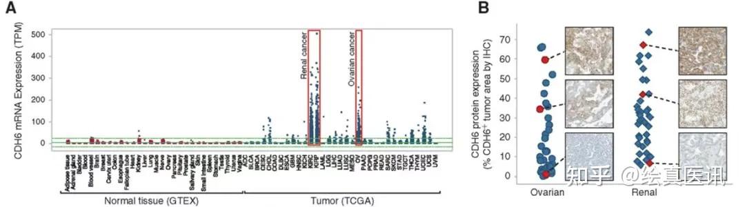 CDH6 ADC「R-Dxd」获FDA突破性治疗认定，用于CDH6表达铂耐药上皮性卵巢癌/原发性腹膜癌/输卵管癌 - 知乎