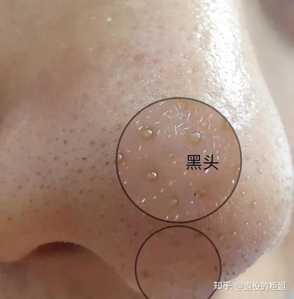 为什么化妆后总是浮粉、卡粉,或者出现干纹? 知乎