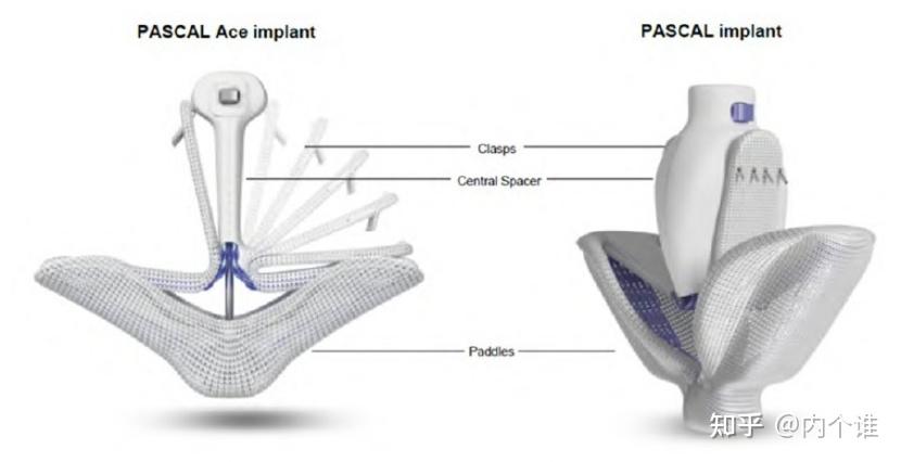 【行业资讯】TriClip G4经导管三尖瓣修复器械 - 知乎