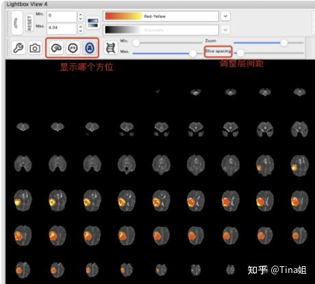 fsleyes -- 一款多功能影像数据查看器 - 知乎