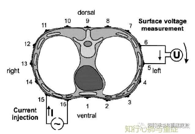 第139期胸部电阻抗断层成像（EIT）的原理、图像分析及临床应用 - 知乎