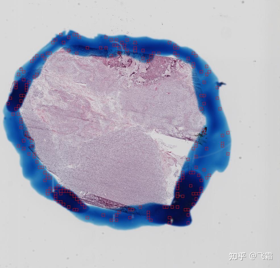 医学图像实战：病理学WSI图像的预处理 - 知乎