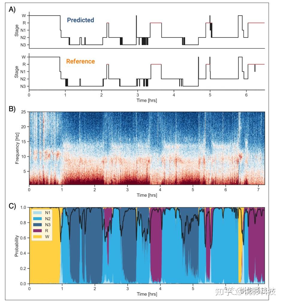 eLife:一个开源、高性能的自动睡眠分期工具 - 知乎