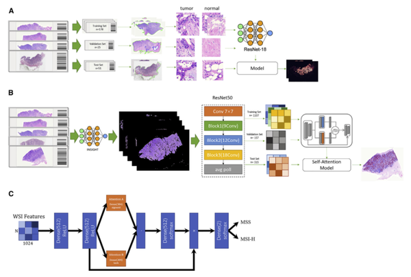 Cell Rep Med︱聂秀/孟斌/全雪萍团队使用自注意力增强的卷积神经网络预测结直肠癌微卫星不稳定性 - 知乎