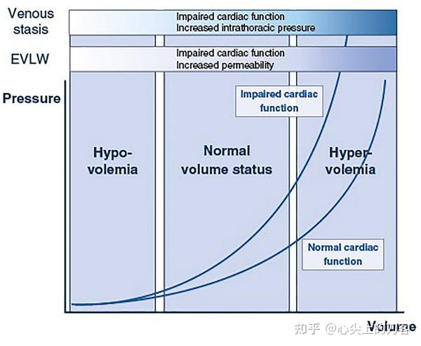 ICM综述：评估血流动力学如何帮助评估容量状态？ - 知乎