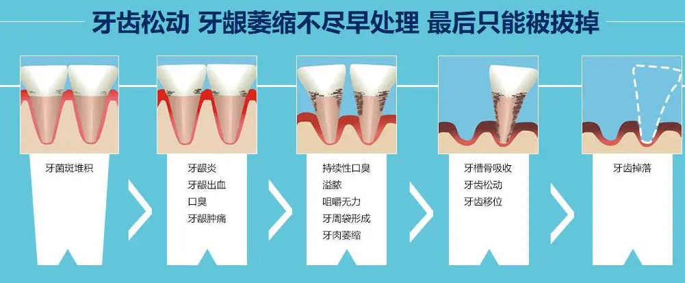 牙龈萎缩该如何治疗？ 知乎