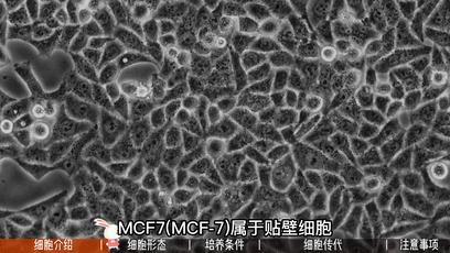 MCF7（MCF-7）细胞培养，人乳腺癌细胞培养攻略 - 知乎