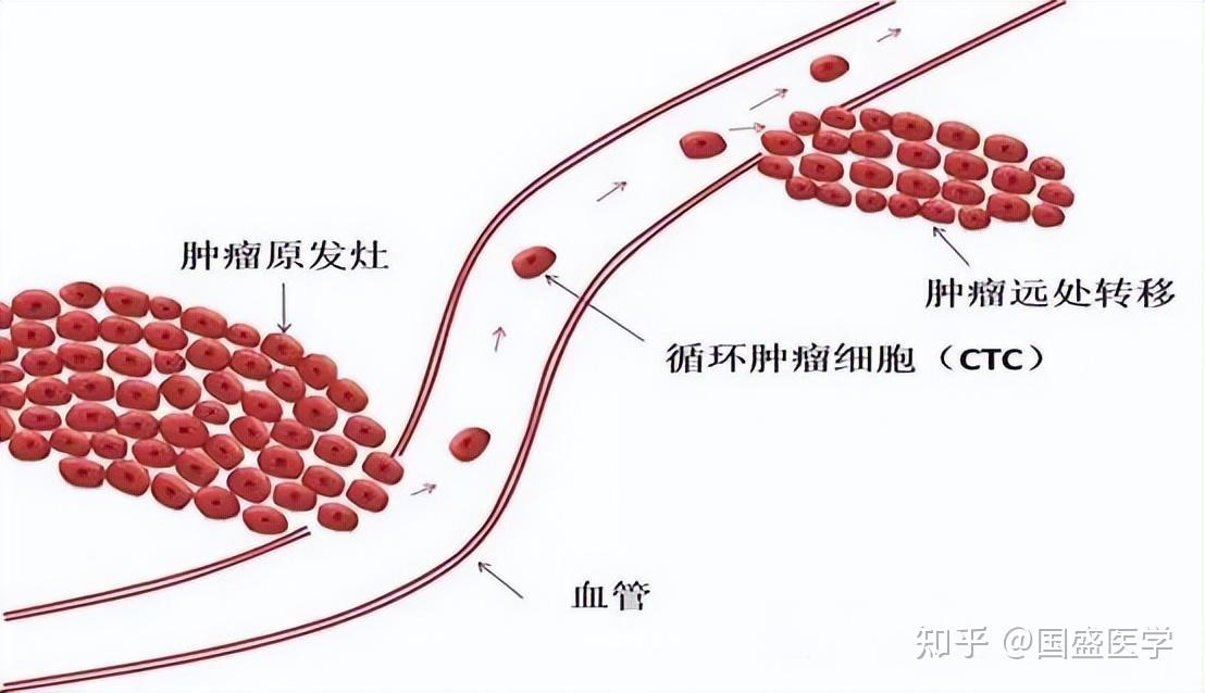 专利保存配方—为液体活检之循环肿瘤细胞CTC保驾护航 - 知乎
