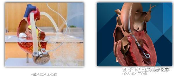 介入式心脏导管泵PVAD - 知乎