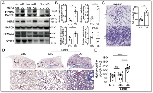 J Exp Med︱蒋典华团队揭示HER2是调控肺成纤维细胞侵袭和肺纤维化新靶点 - 知乎