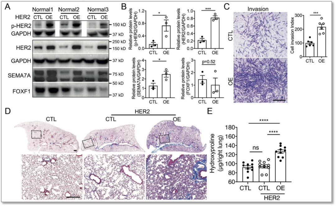 J Exp Med︱蒋典华团队揭示HER2是调控肺成纤维细胞侵袭和肺纤维化新靶点 - 知乎