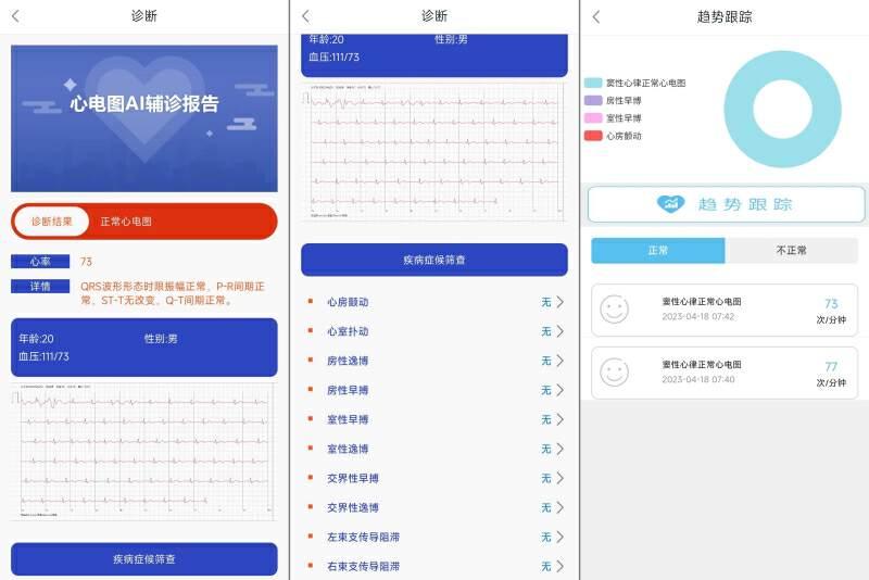 心电血糖都能测？比某为便宜1000多，dido E10S Pro智能手表体验