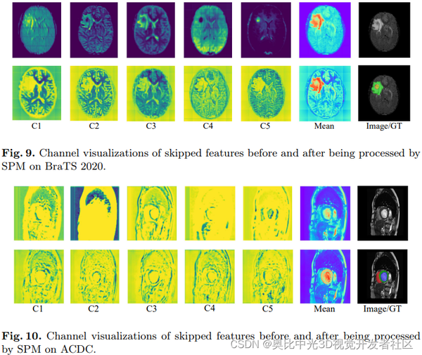 SPM: 一种即插即用的形状先验模块! - 知乎