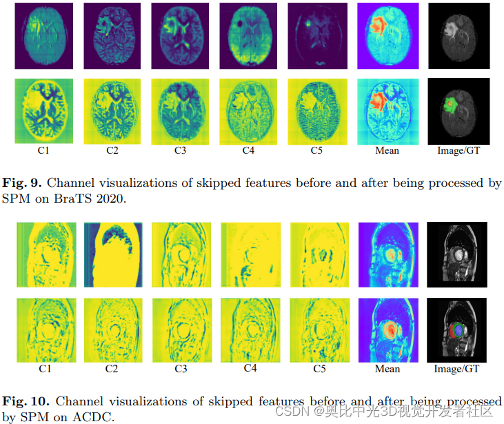 SPM: 一种即插即用的形状先验模块! - 知乎